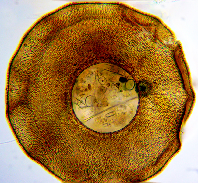 The rare Arcella formosa - MicrobeHunter.com Microscopy Forum
