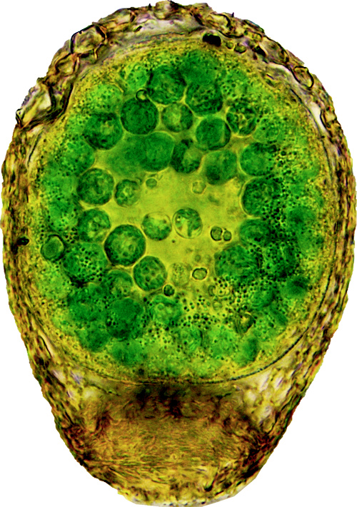 Lost in space? - MicrobeHunter.com Microscopy Forum