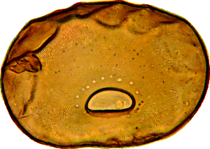 Arcella catinus